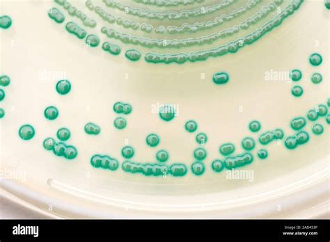 Mrsa Methicillin Resistant Staphylococcus Aureus Culture On A Chromogenic Mrsa Screening