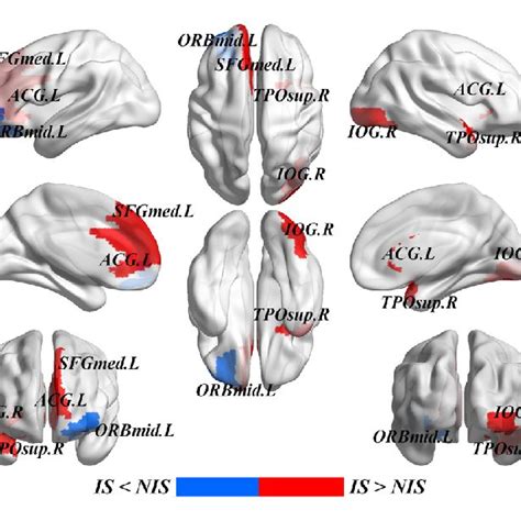 Brain Areas With Altered Nodal Betweenness Centrality Nodal Degree Download Scientific