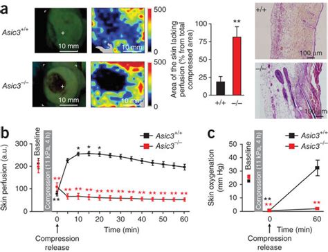 The Ischemic Response To Compression Is Exacerbated By Asic Download Scientific Diagram