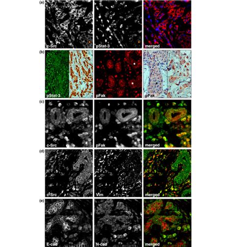 The Correlation Of C Src Activity With An Emt A Nuclear Pstat 3 Download Scientific Diagram