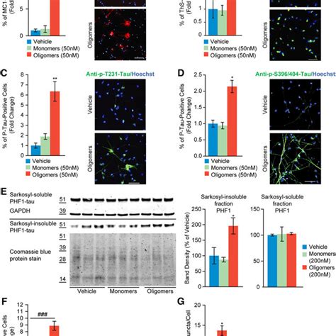 Accumulation Of Pathological Tau Causes Neuronal Degeneration A Download Scientific Diagram