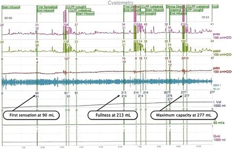 Urodynamics Indications Techniques Interpretation And Clinical