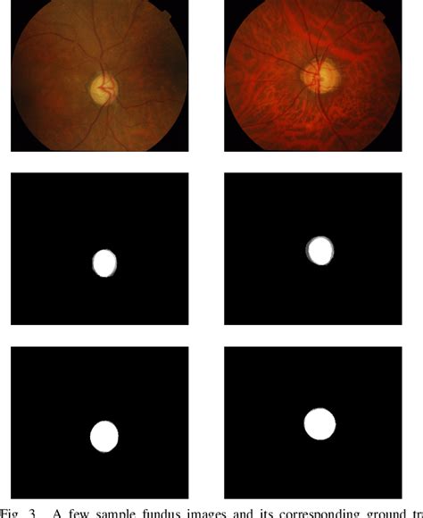 Figure 3 From Semantic Segmentation Of Optic Disc And Optic Cup Using Deep Learning Semantic