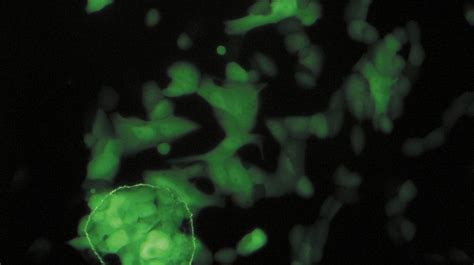 Microscopes De Dissection Leica Microsystems