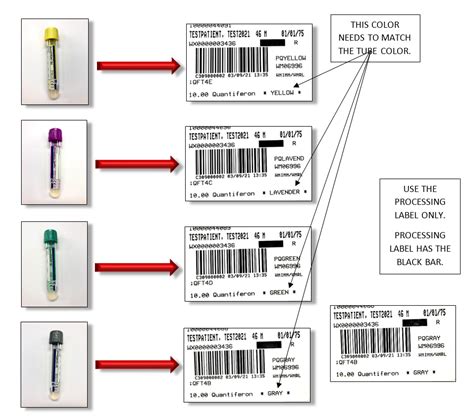 Updated Tb Testing By Qft Plus Warde Medical Laboratory