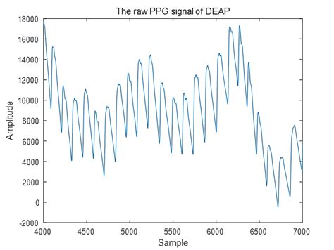 Ppg Signal Of Dataset For Emotion Analysis Using Physiological Deap Download Scientific Diagram