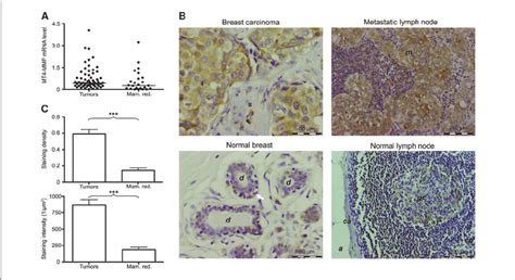Expression Of Mt4 Mmp In Human Breast Adenocarcinomas A Relative Mrna