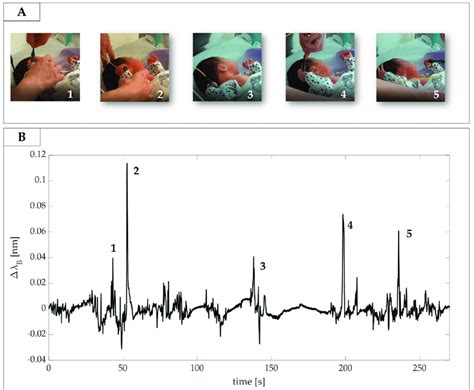 A Video Frames Of Grasping Actions Identified By The Clinicians B Download Scientific