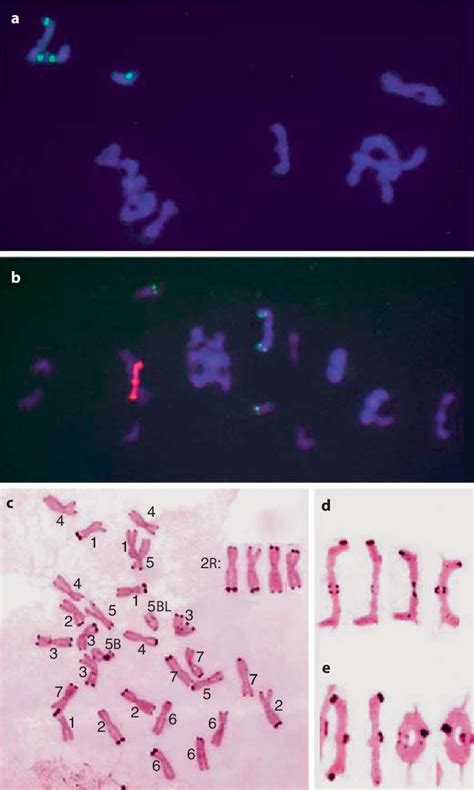 Figure 1 From The Ph1 Locus From Wheat Controls Meiotic Chromosome