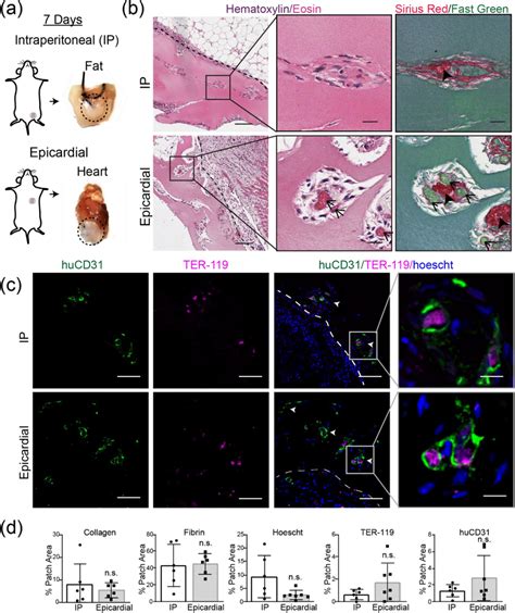 Guided Vascularization Occurs In Intra Peritoneal Ip And Epicardial