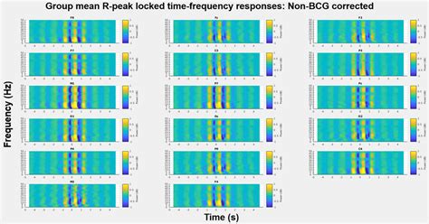 Group Mean N 20 Timefrequency Representations Tfrs Of Download Scientific Diagram