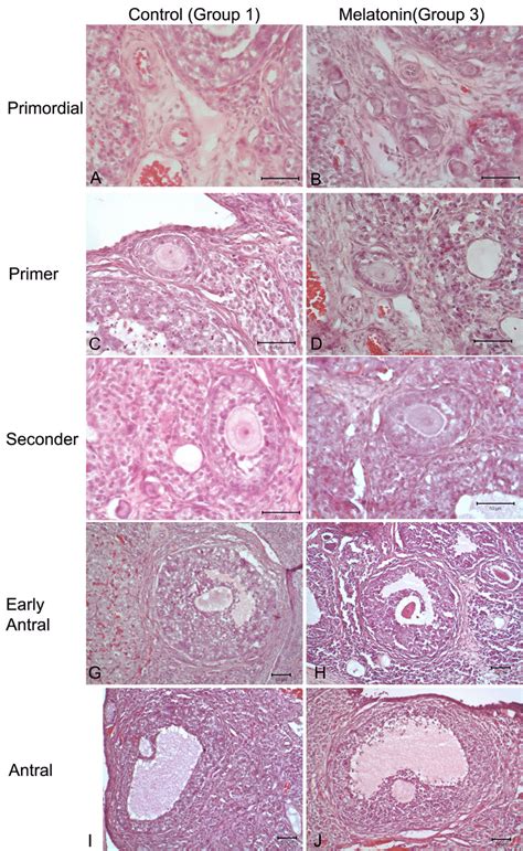 Histomorphometric Analysis Histomorphometric Assessment Of