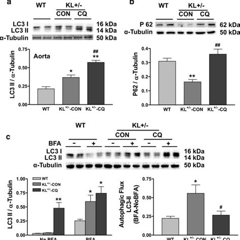 Chloroquine Suppressed Autophagy In Klotho Deficient Mice Kl − A Download Scientific