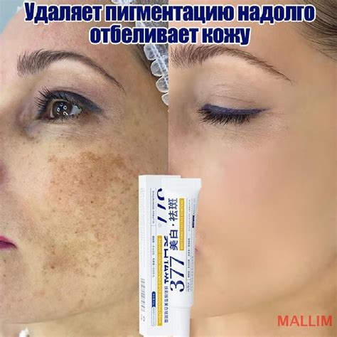 крем против пигментных пятен и веснушек с Витаминами С и Е и Гиалуроновой кислотой Средство