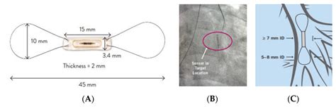 In Search Of Clinical Impact Advanced Monitoring Technologies In Daily