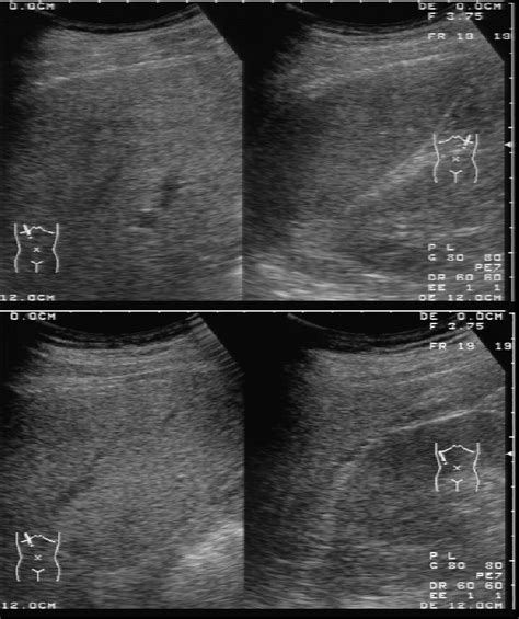 Textures Used For Classification Algorithms Download Scientific Diagram