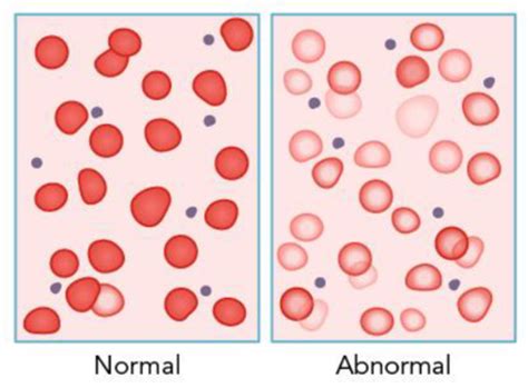 Alterations In Hematologic Function Flashcards Quizlet