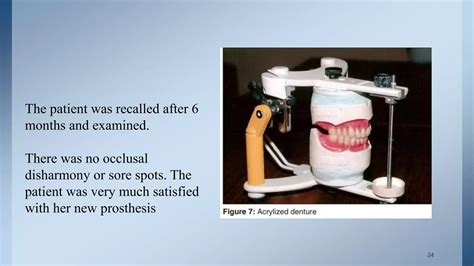 Biofunctional Prosthetic System Pptx