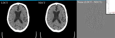 Example Samples Of The Used Abdomen And Head Datasets The Noise Map Of