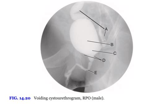 Voiding Cystourethrogram Diagram Quizlet Voiding Cystourethrogram Diagram Quizlet