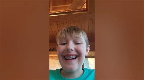 I Got Braces Youtube