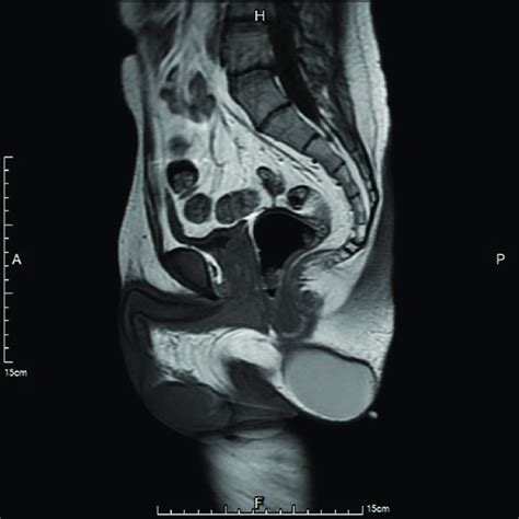 Clinical Picture Showing Ulcerative Scalp Lesion Download Scientific Diagram