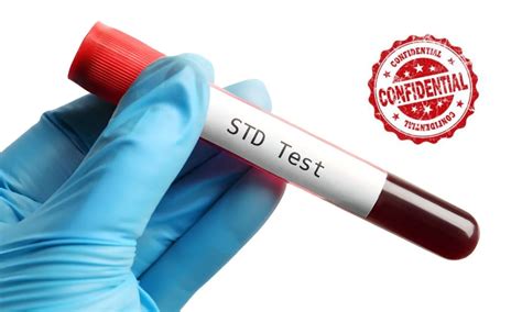 Confidential Std Testing Options And Treatments Pregnancy Boss