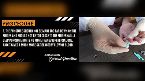 Dermal Puncture Procedure Youtube