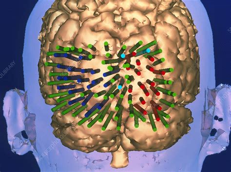 Functional Map Of The Brain S Visual Cortex Areas Stock Image P335