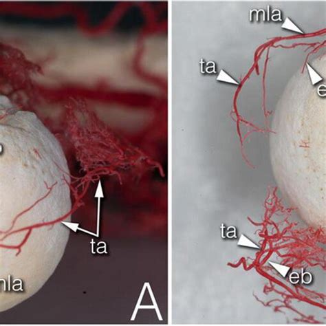 Supplying Branches To The Metacarpal Territory On Corrosion Cast Download Scientific Diagram