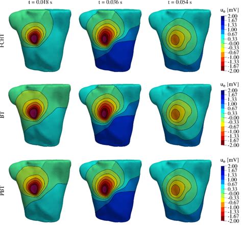 Body Surface Potential Maps Computed With The Fully Coupled Heart Torso Download Scientific