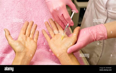 Beautician Makes Intramuscular Injections Of Botulinum Toxin In Palm Against Hyperhidrosis
