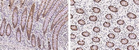 Rab5 Antibody Pa5 81537