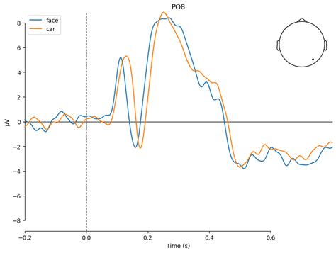 5 Pipeline — Introduction To Eeg Analysis