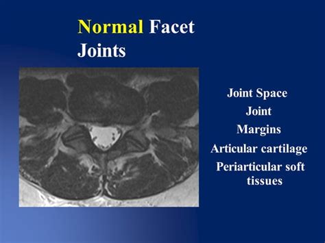 Facetjointinjectioncomments 191123152135pptx