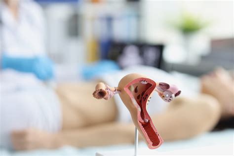 Ovulation Induction Dr Sonal Women S Care