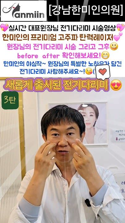 ️실시간 대표원장님 전기다리미 시술영상3탄 ️한미인의 프리미엄고주파 탄력레이저💕원장님의 전기다리미시술 그리고 그후 확인해보세요😆😁한미인의 야심작~전기다리미사랑해주세요