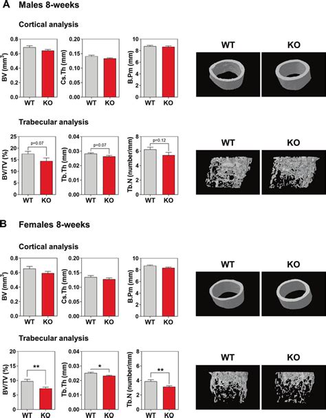 Female Associated Osteopenia In Young Herc1 Knockout Mice Bone