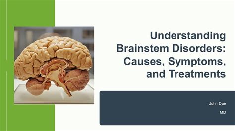 Understanding Brainstem Disorders Causes Symptoms And Treatments Ppt