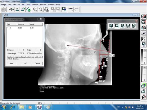 Linear Measurements Of Soft Tissue Analysis Within Digital Image