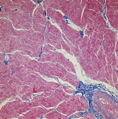 Cardiac Muscle Light Micrograph Stock Image C Science Photo Library