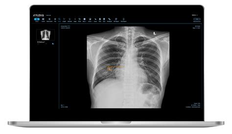 Xycad Cxr Xylexa