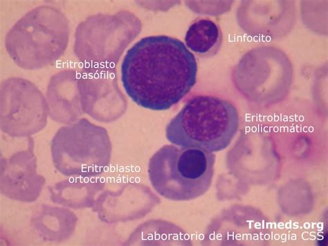 Hematologia Eritroblastos Facebook