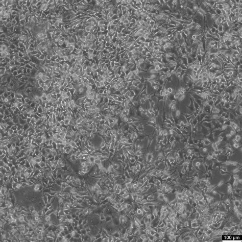 K7M2 wt Cells