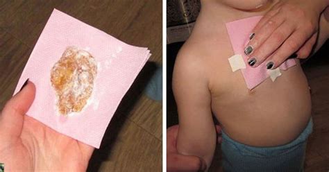 ბებიის სამკურნალო რეცეპტები