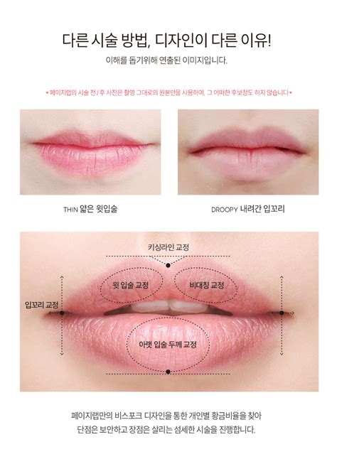 필러 입술필러 Page Lab Clinic 페이지랩 안티에이징 전문 클리닉