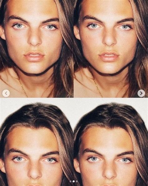 Damian Hurley Explains His Shocking New Shaved Head Look Lqzw