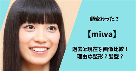 【2025】miwaが顔変わった？過去と現在を画像比較！理由は整形？ いきぬきブログ