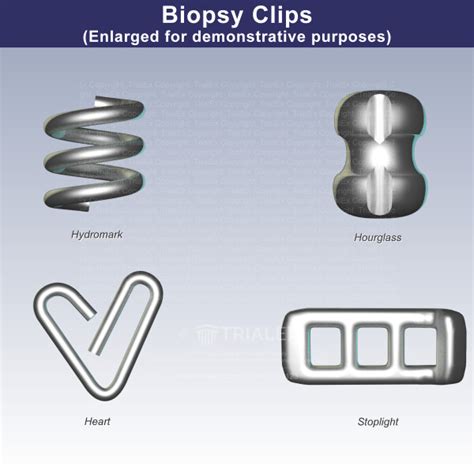 Excisional Biopsy Vs Wide Excision Trial Exhibits Inc