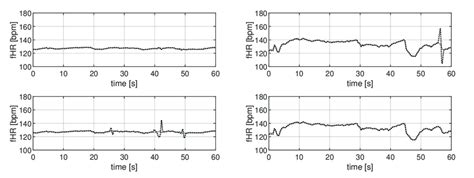 Examples Of Outcomes On Ds Pn Comparison Of The Fhr Estimation With Va
